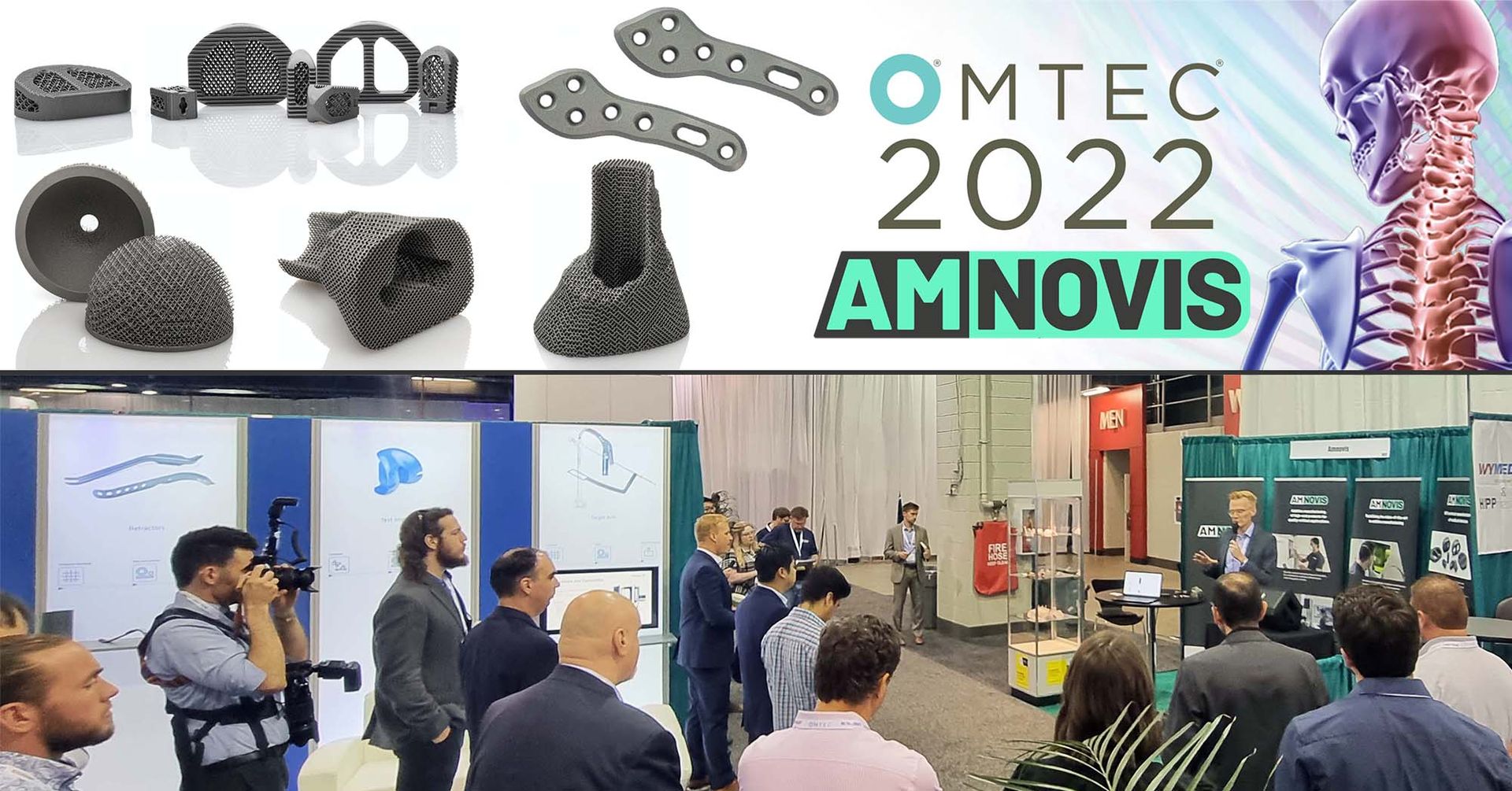 News | Successful Amnovis exhibit and presentation at OMTEC in Chicago